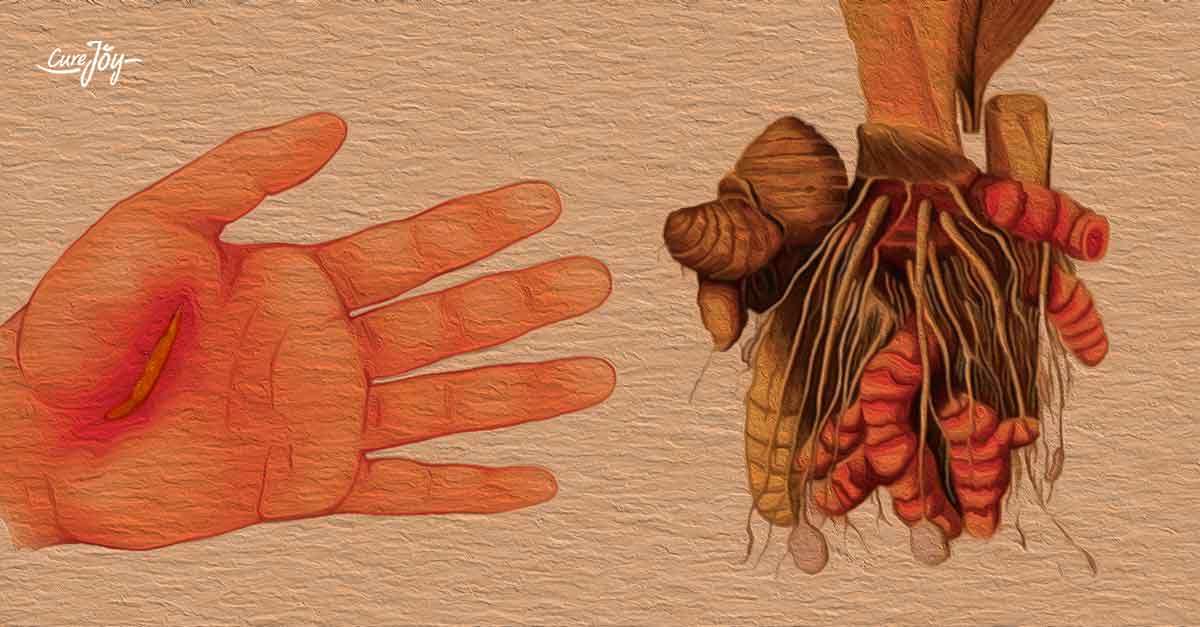 How To Treat An Infected Wound At Home