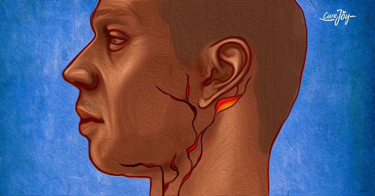 What You Need To Know About That Lump Behind Your Ear